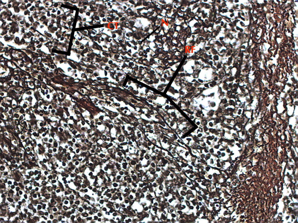 Reticular Connective Tissue 20x Histology reticular-connective-tissue-20x-histology